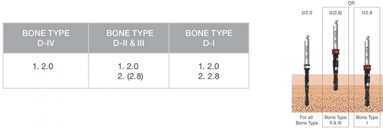 Fix Konisch ND 3.0 - Medigma Biomedical GmbH