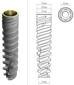 Fix Konisch ND 3.0 - Medigma Biomedical GmbH